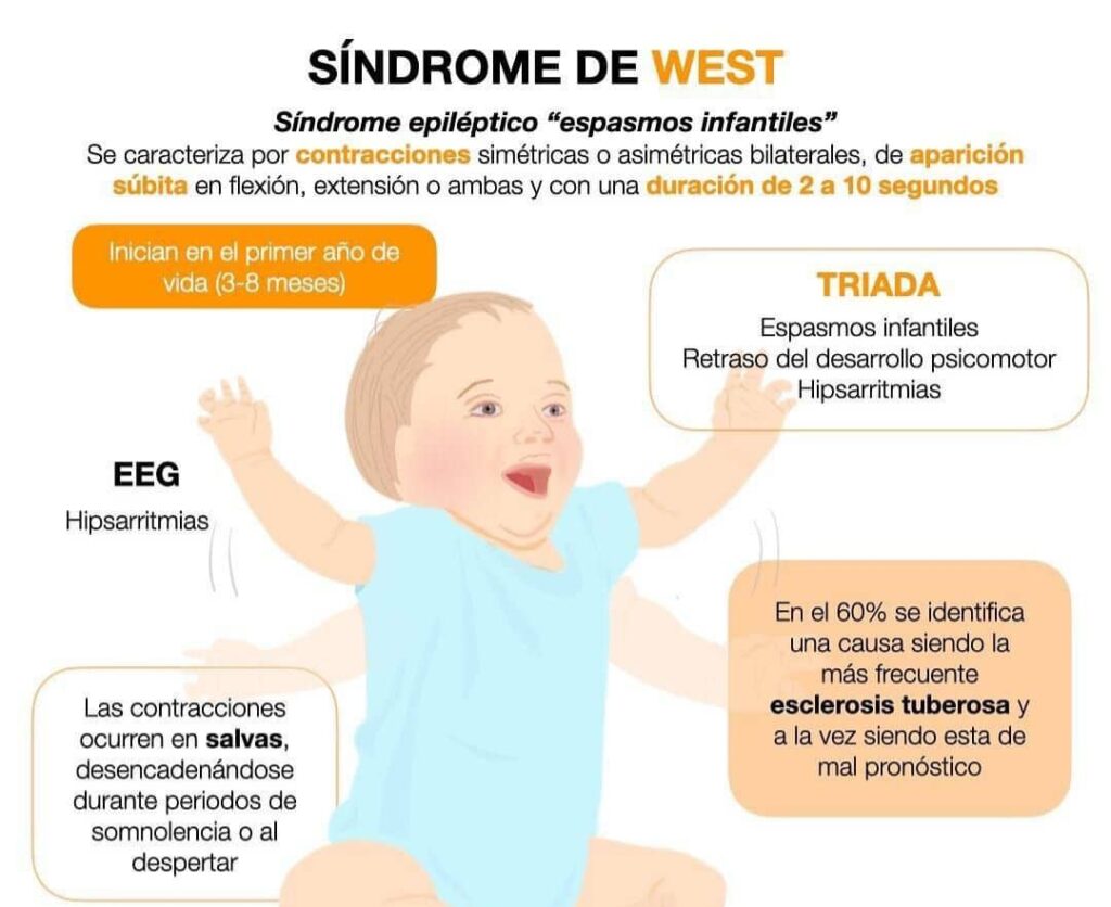 ¡Alerta! Con el Síndrome de West una rara epilepsia en niños - Agencia ...
